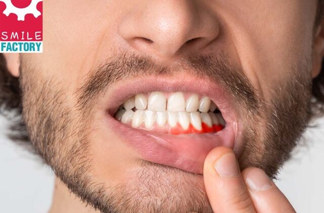 Smile Factory Dental Clinic Goa | Best Dentist in North Goa India