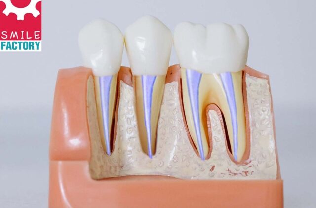 Smile Factory Dental Clinic Goa | Best Dentist in North Goa India